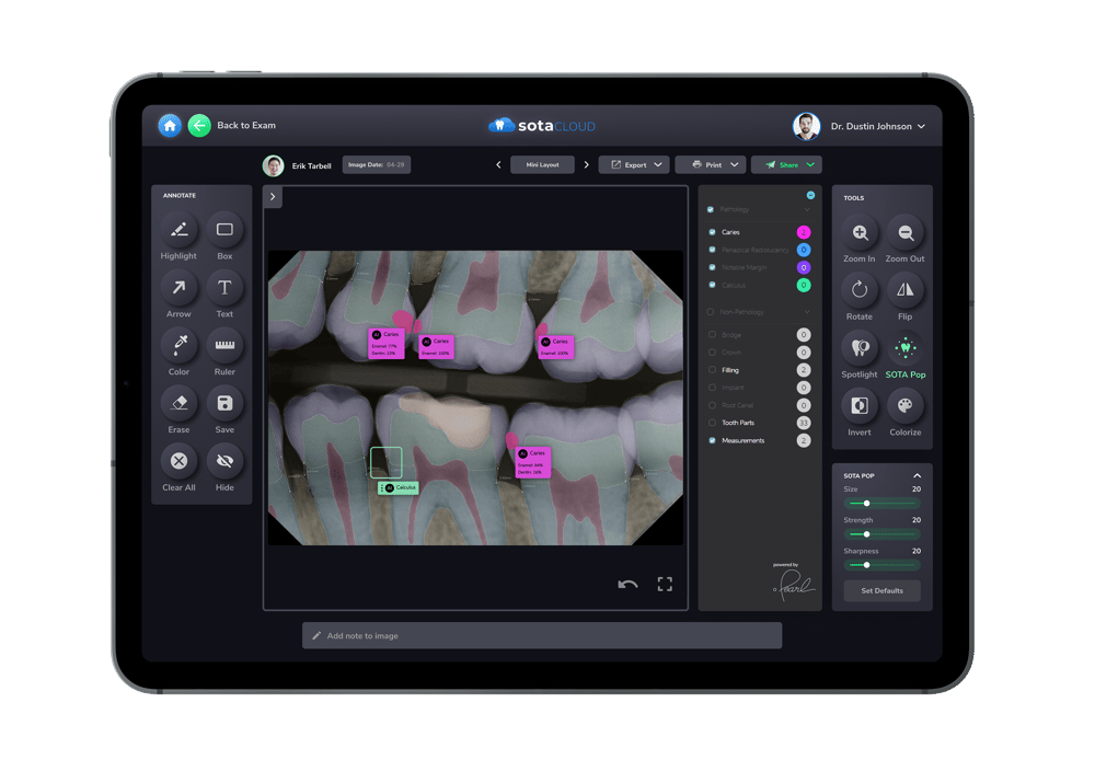 SOTA Cloud | Modern Dental Imaging Software Powered by AI
