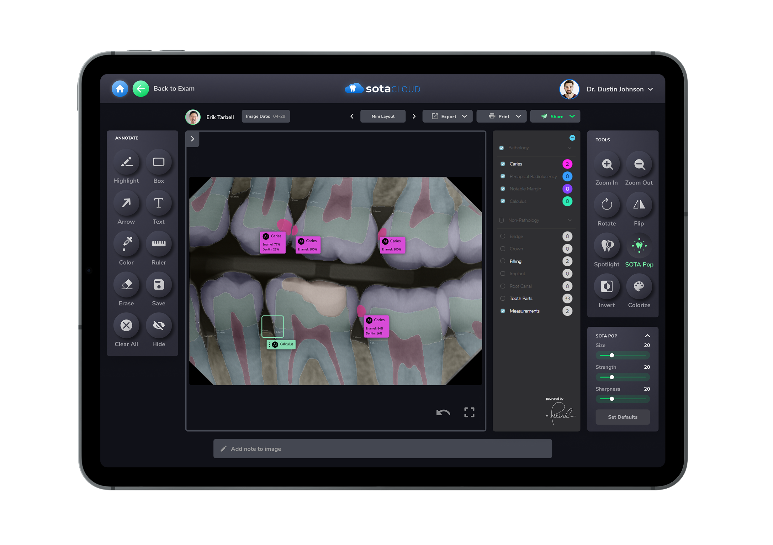 SOTA Cloud | Modern Dental Imaging Software Powered by AI