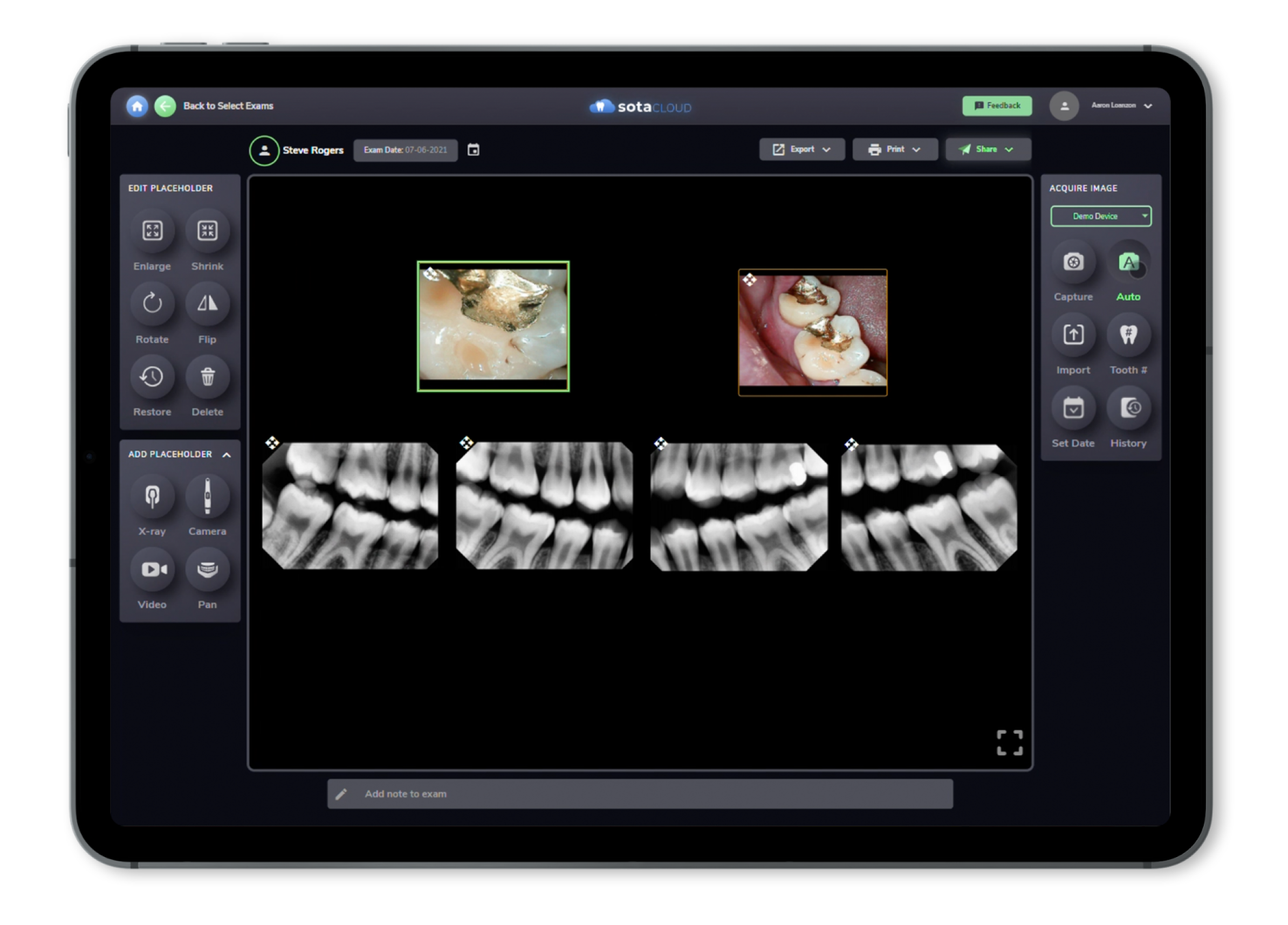 SOTA Cloud | Modern Dental Imaging Software Powered by AI
